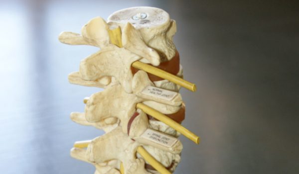 Chiropractic | Spineline | Chiro Essendon